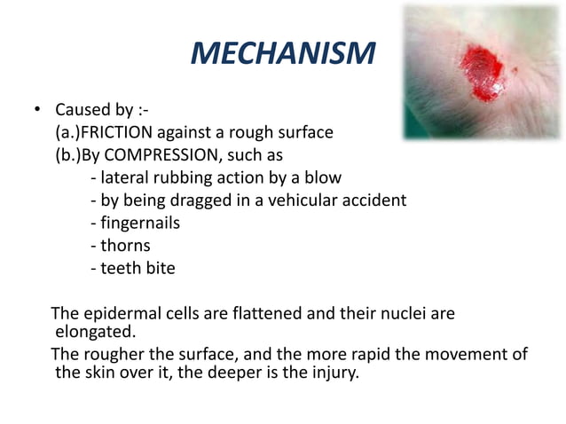 Abrasions | PPTX