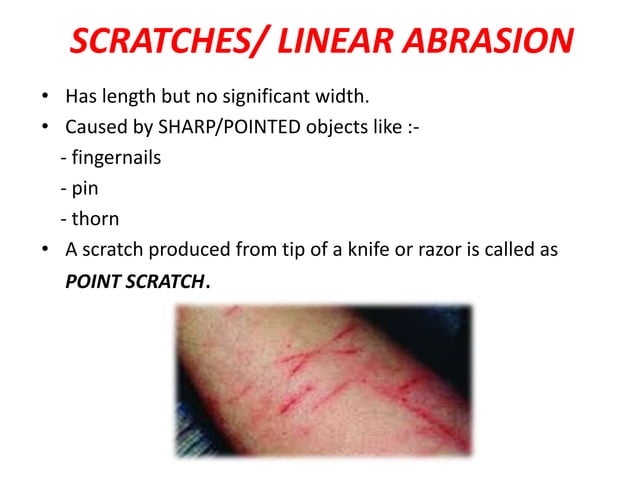 Abrasions | PPTX