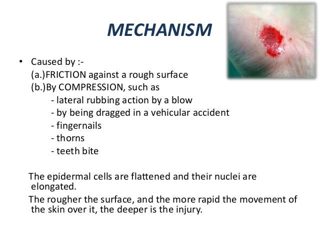 Abrasion Wound Diagram