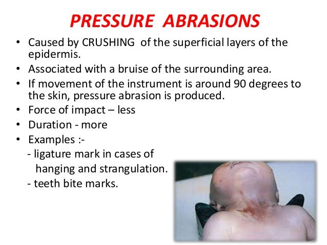 Abrasions