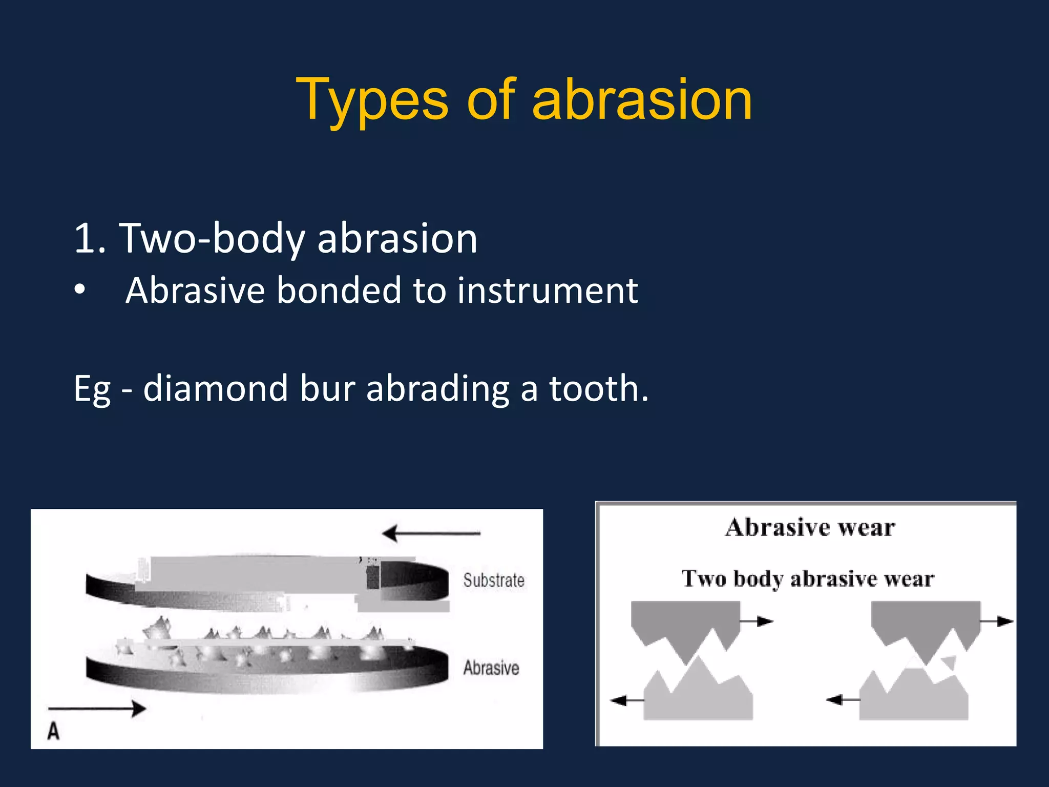 Abrasive agents in dentistry | PPTX