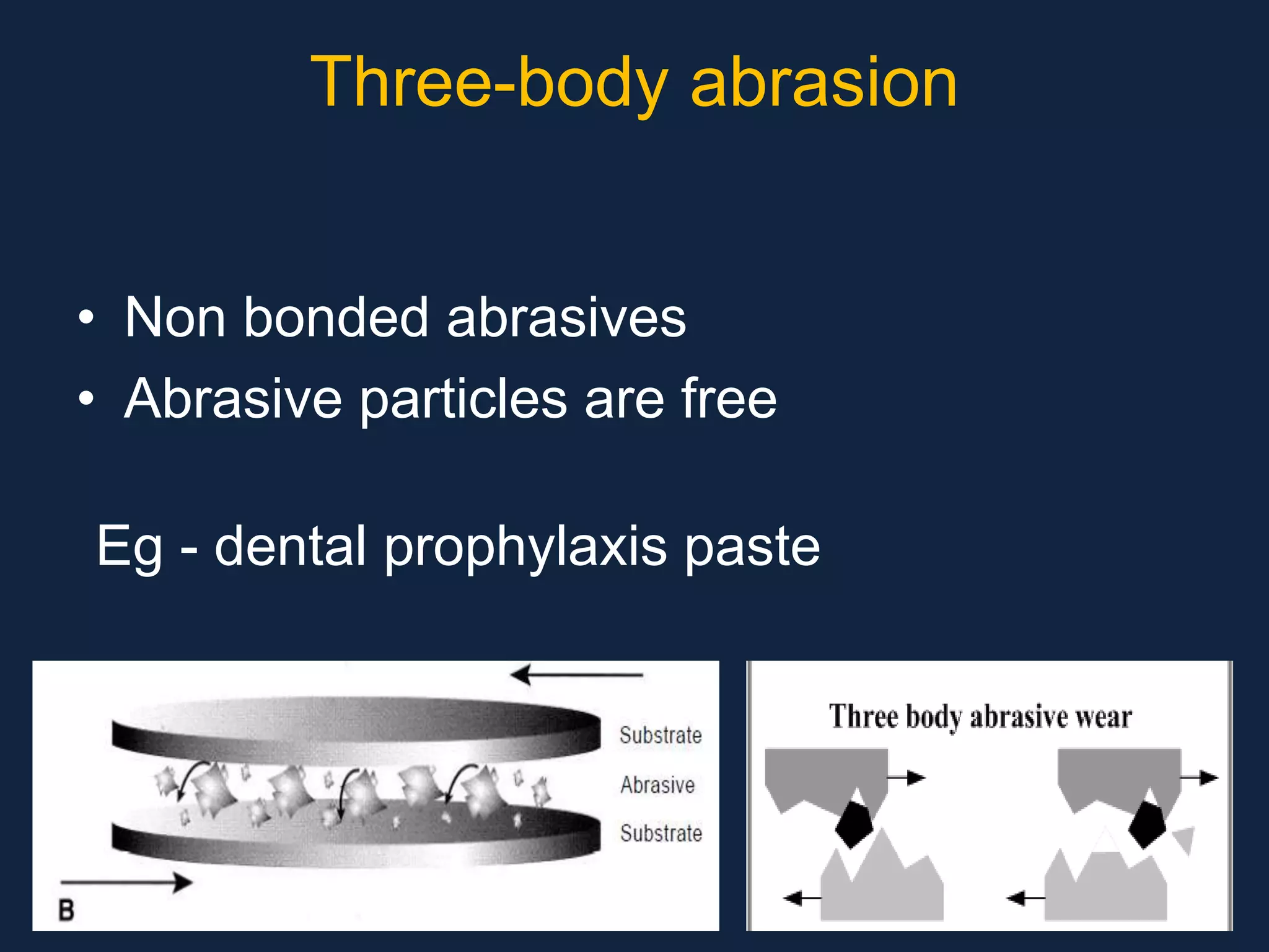 Abrasive agents in dentistry | PPTX