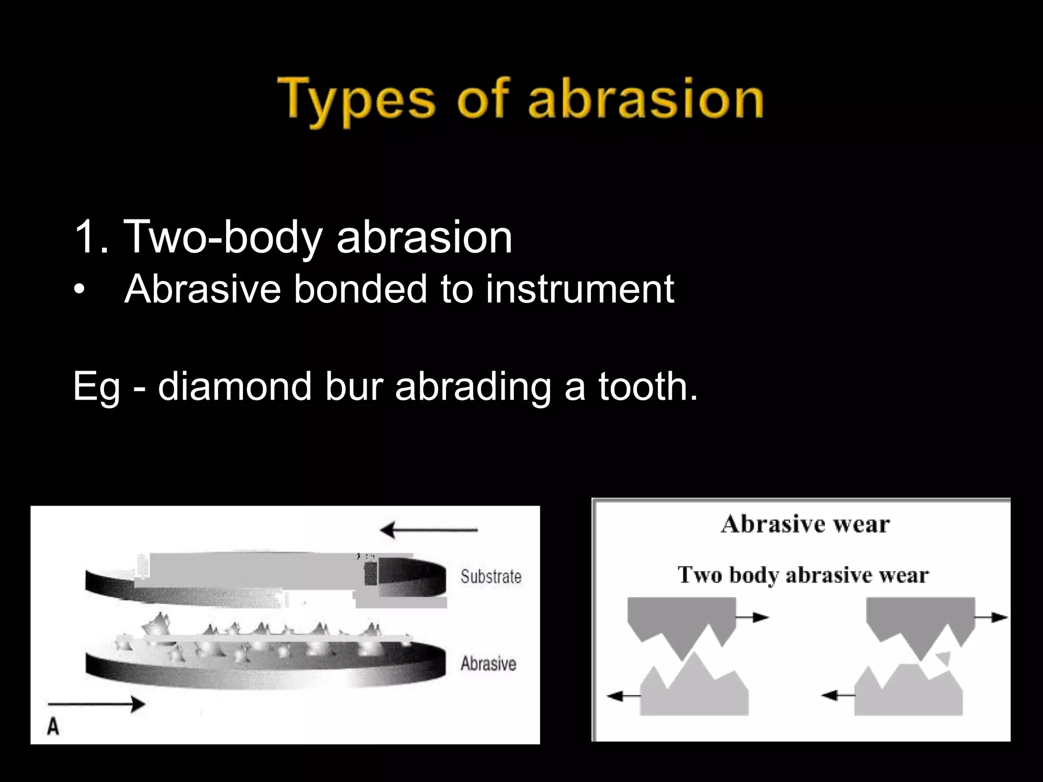 Abrasives and polishing agents in dentistry | PPTX