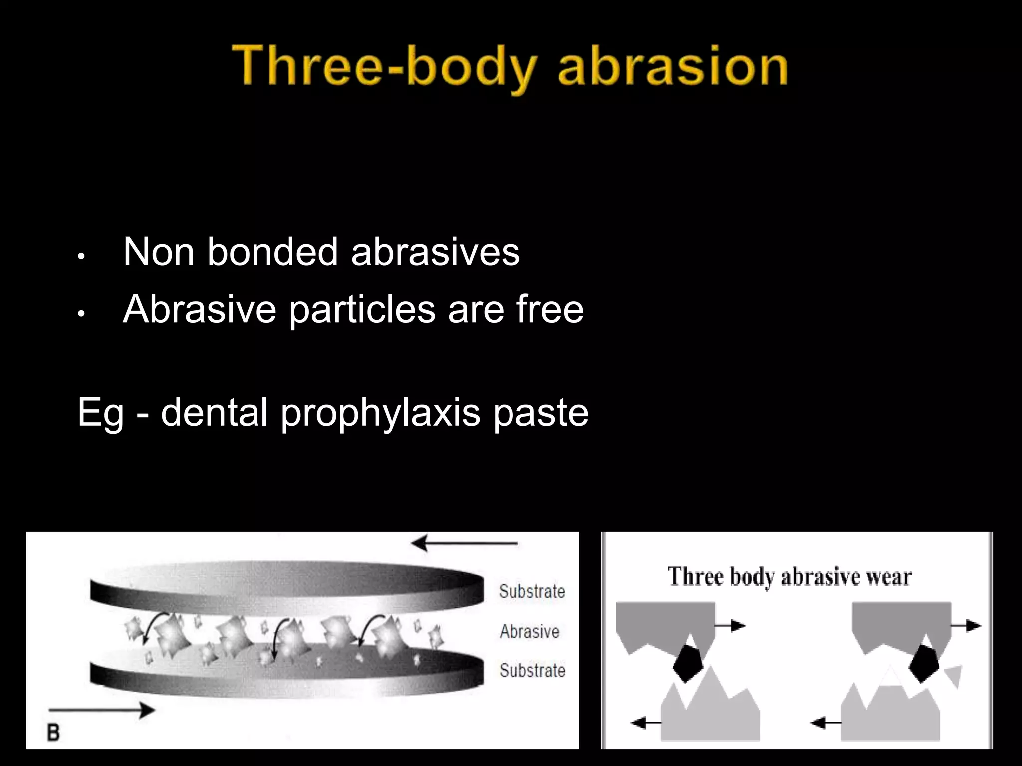 Abrasives and polishing agents in dentistry | PPTX