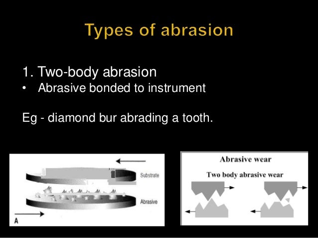Abrasives and polishing agents in dentistry