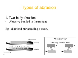 ABRASIVES AND POLISHING AGENTS for fental students | PPTX