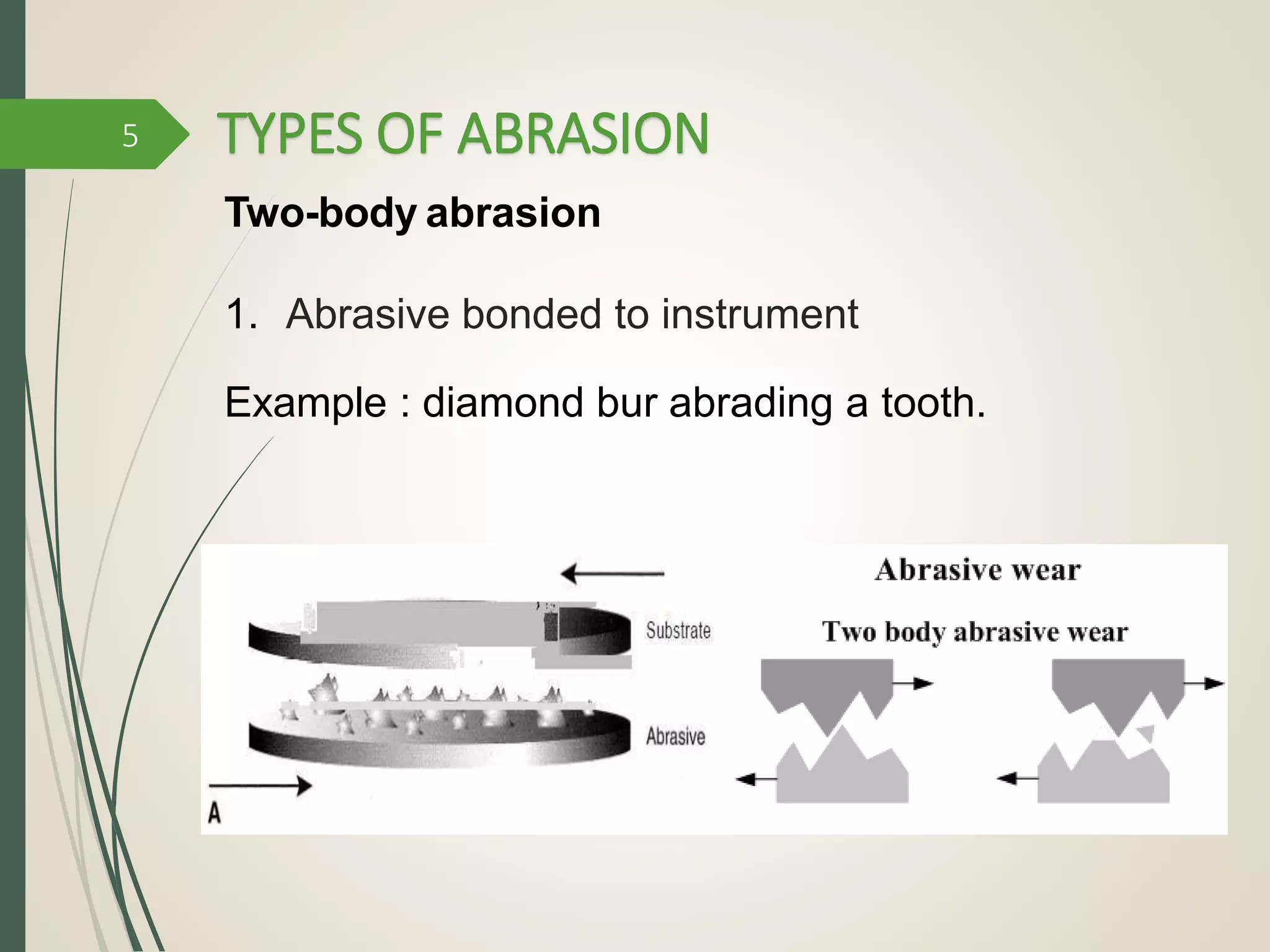 Abrasives and polishing agents of dentistry | PPTX
