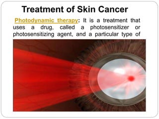 A brief introduction about skin cancer | PPTX