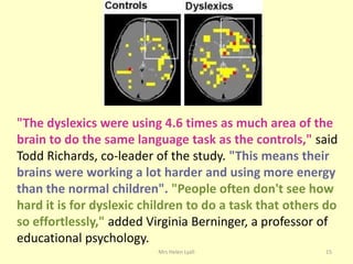 A brief look at dyslexia | PPTX