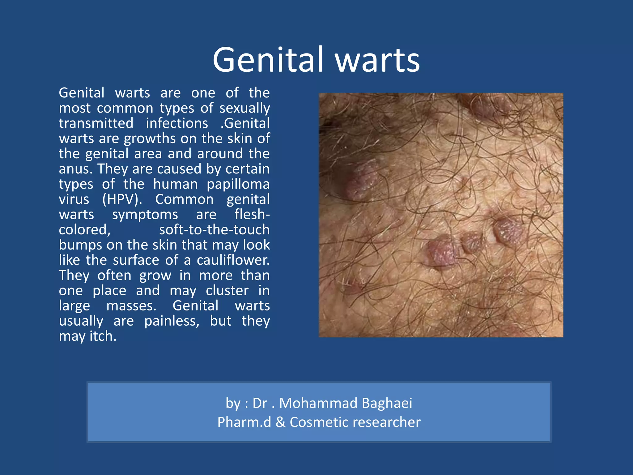 A brief review :Skin Cysts, Lumps, and Bumps | PPTX