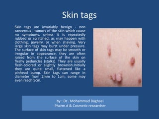 A brief review :Skin Cysts, Lumps, and Bumps | PPTX