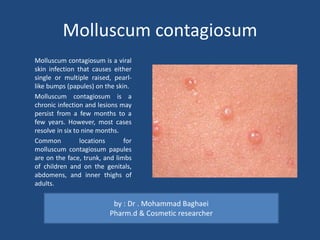 A brief review :Skin Cysts, Lumps, and Bumps | PPTX