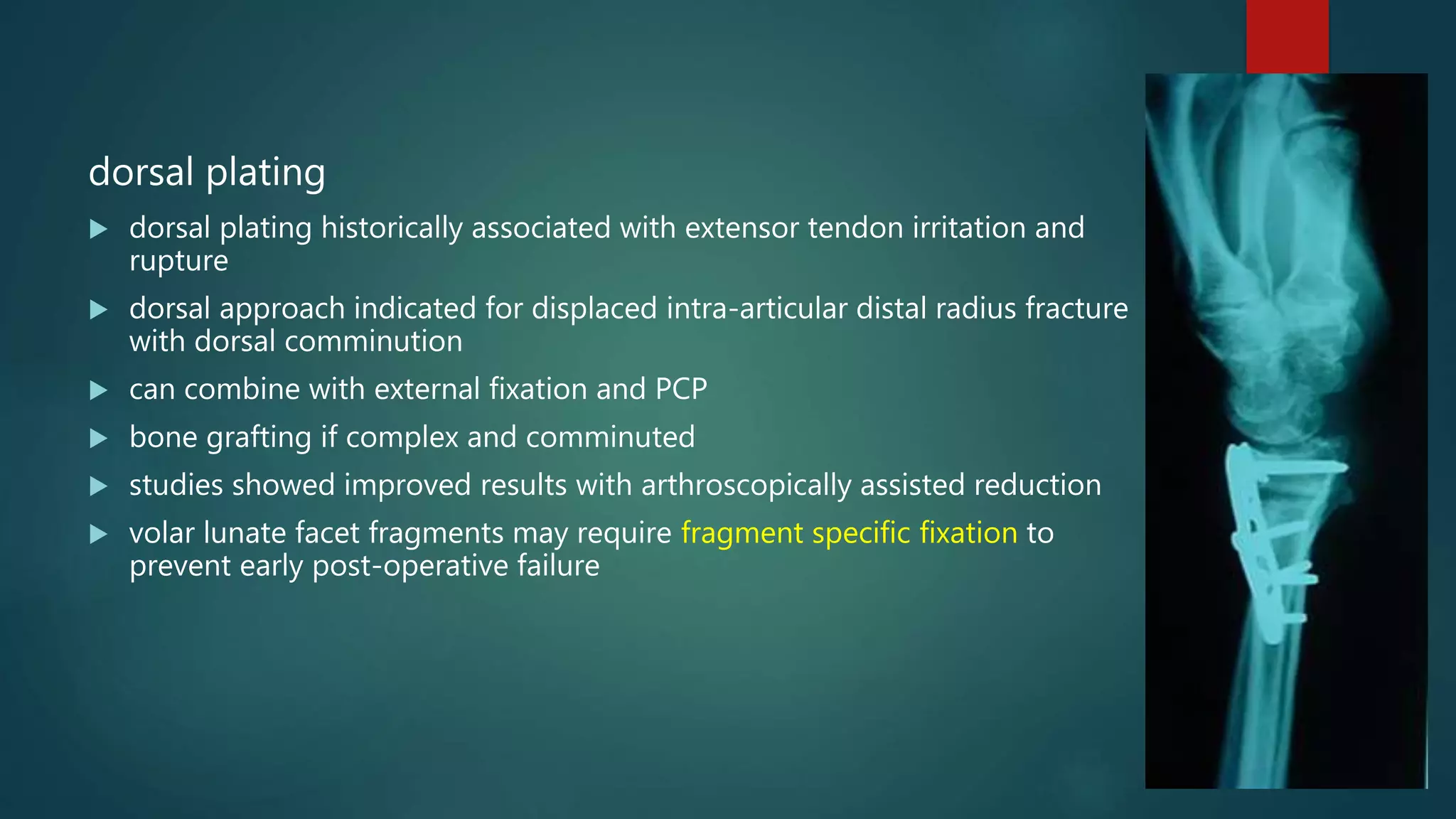 A brief review of distal radius fractures | PPTX
