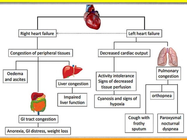 A brief synopsis of acute decompensated heart failure | PPT