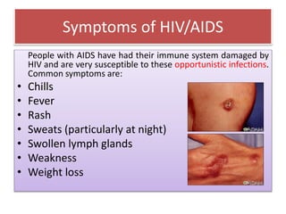 A brief talk on hiv aids college seminer | PPTX