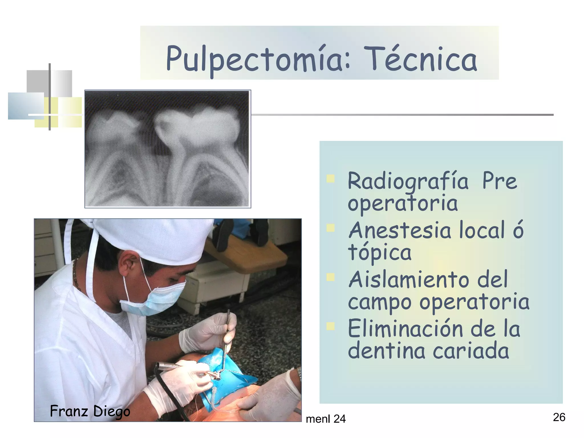 Abril Endodoncia en la Dentición Decidua | PPT | Dental Health ...