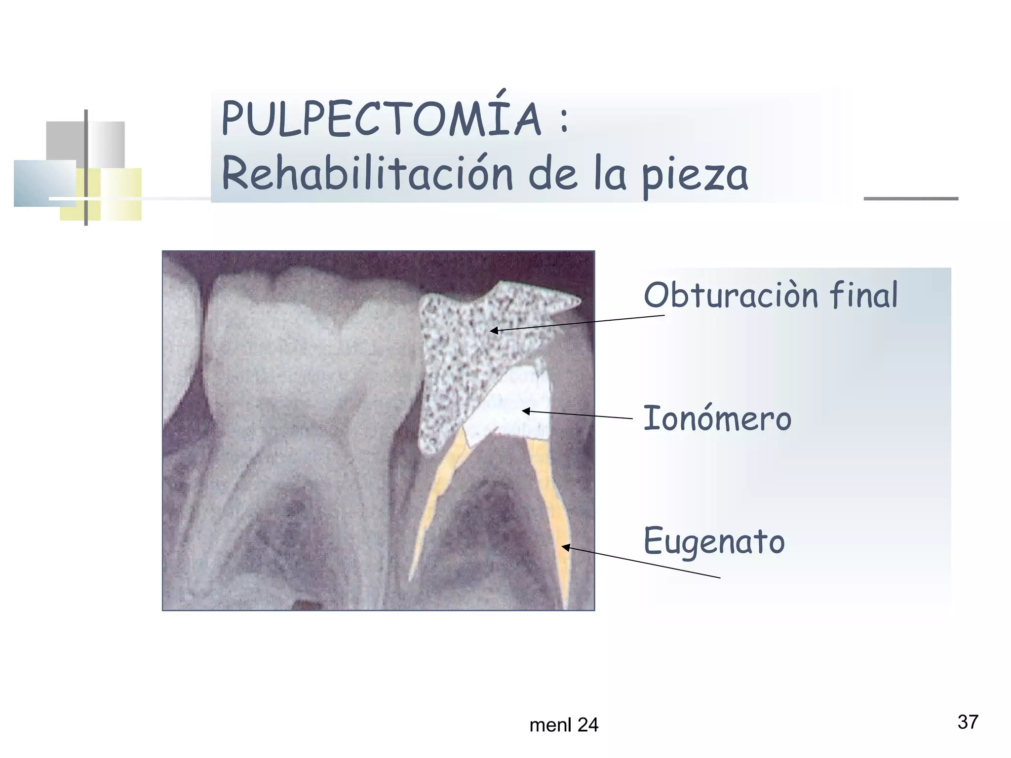 Abril Endodoncia en la Dentición Decidua | PPT | Dental Health ...