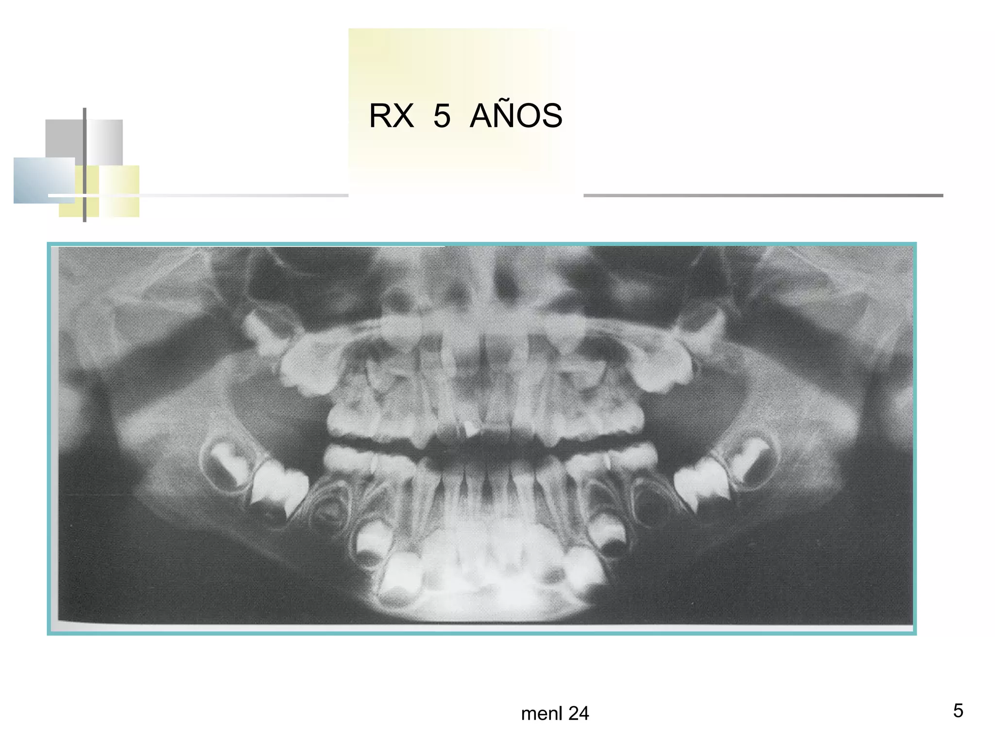 Abril Endodoncia en la Dentición Decidua | PPT | Dental Health ...