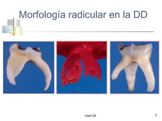 Abril Endodoncia en la Dentición Decidua | PPT