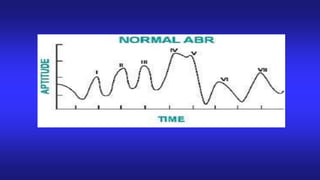 ABR master ppt.pptx