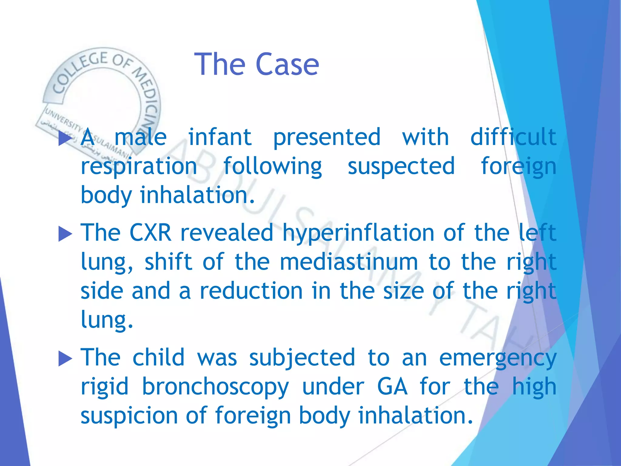 A Bronchial Foreign Body with Obstructive Emphysema.pdf