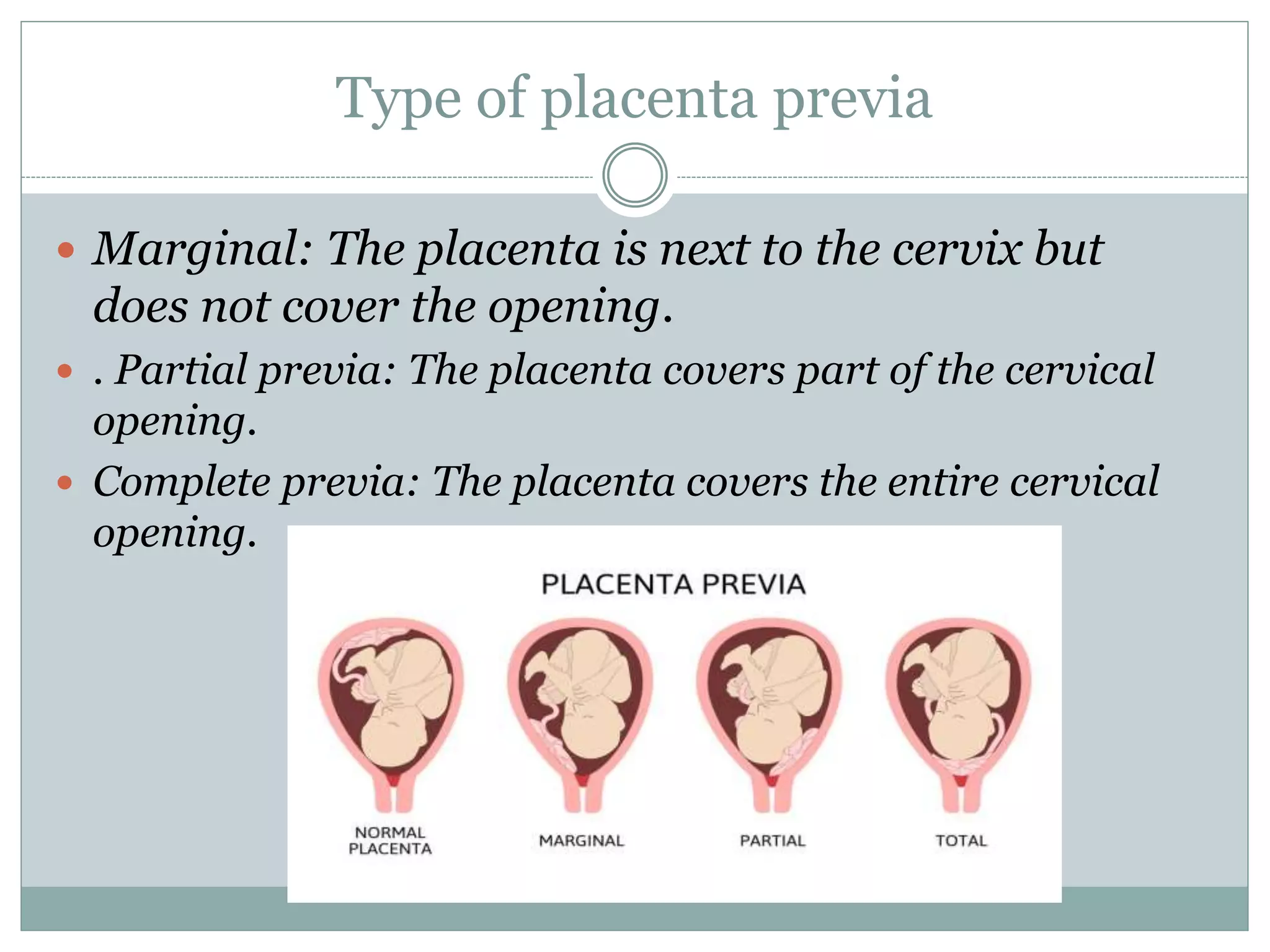 Abruption Placenta & Placenta Previa (1).pptx