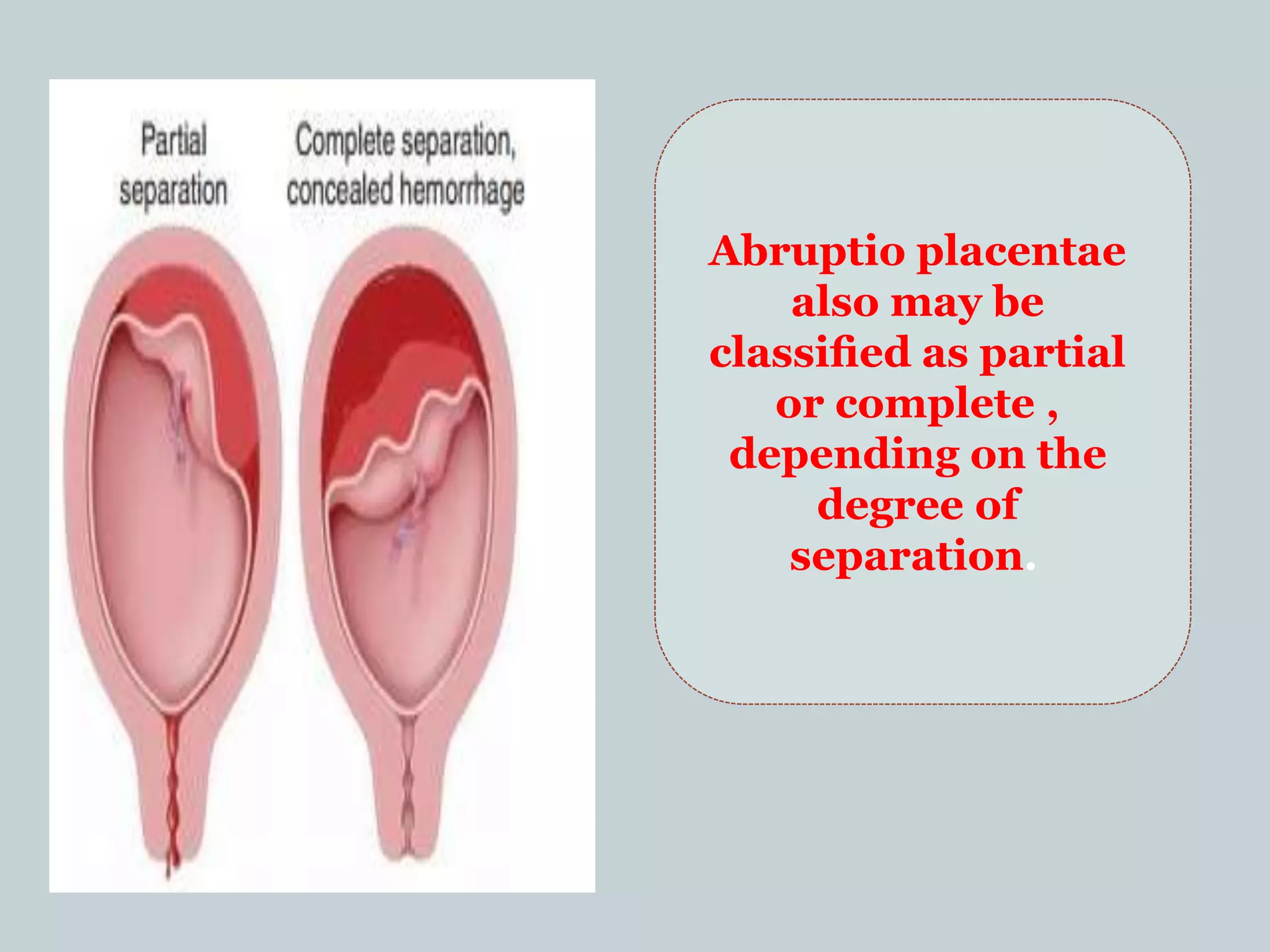 Abruption Placenta And Placenta Previa 1 Pptx
