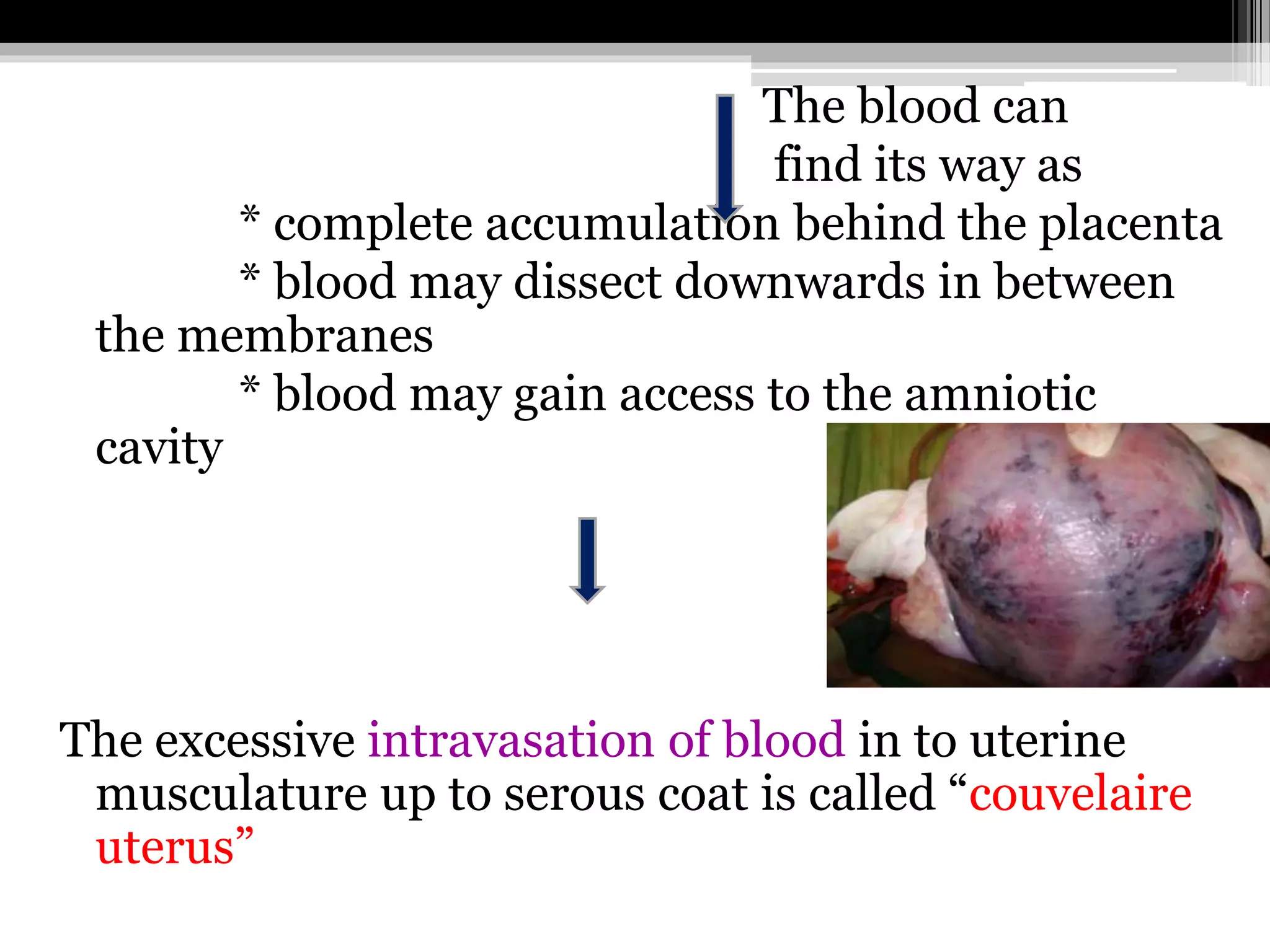 ABRUPTIO PLACENTA.pptx