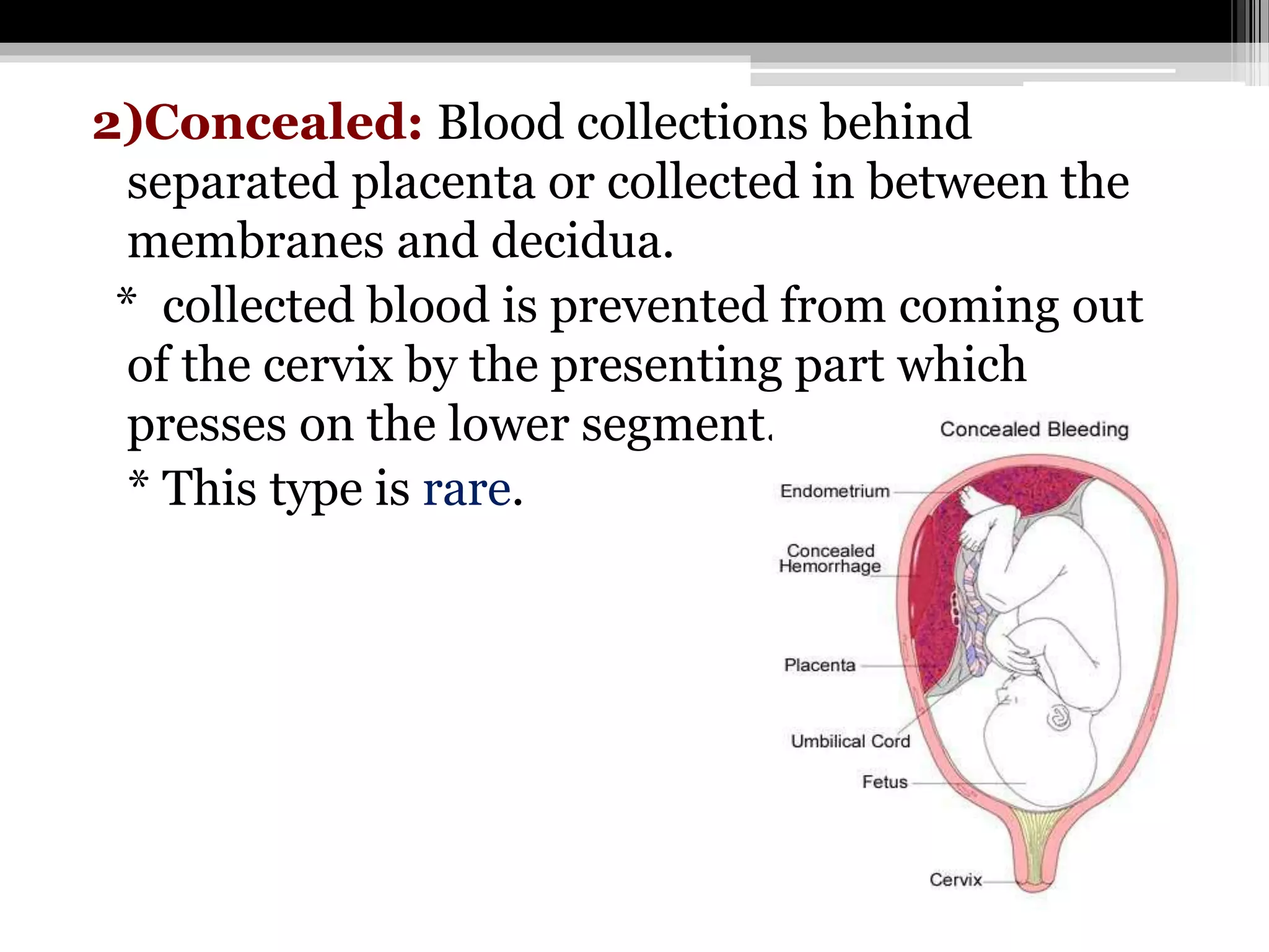 ABRUPTIO PLACENTA.pptx