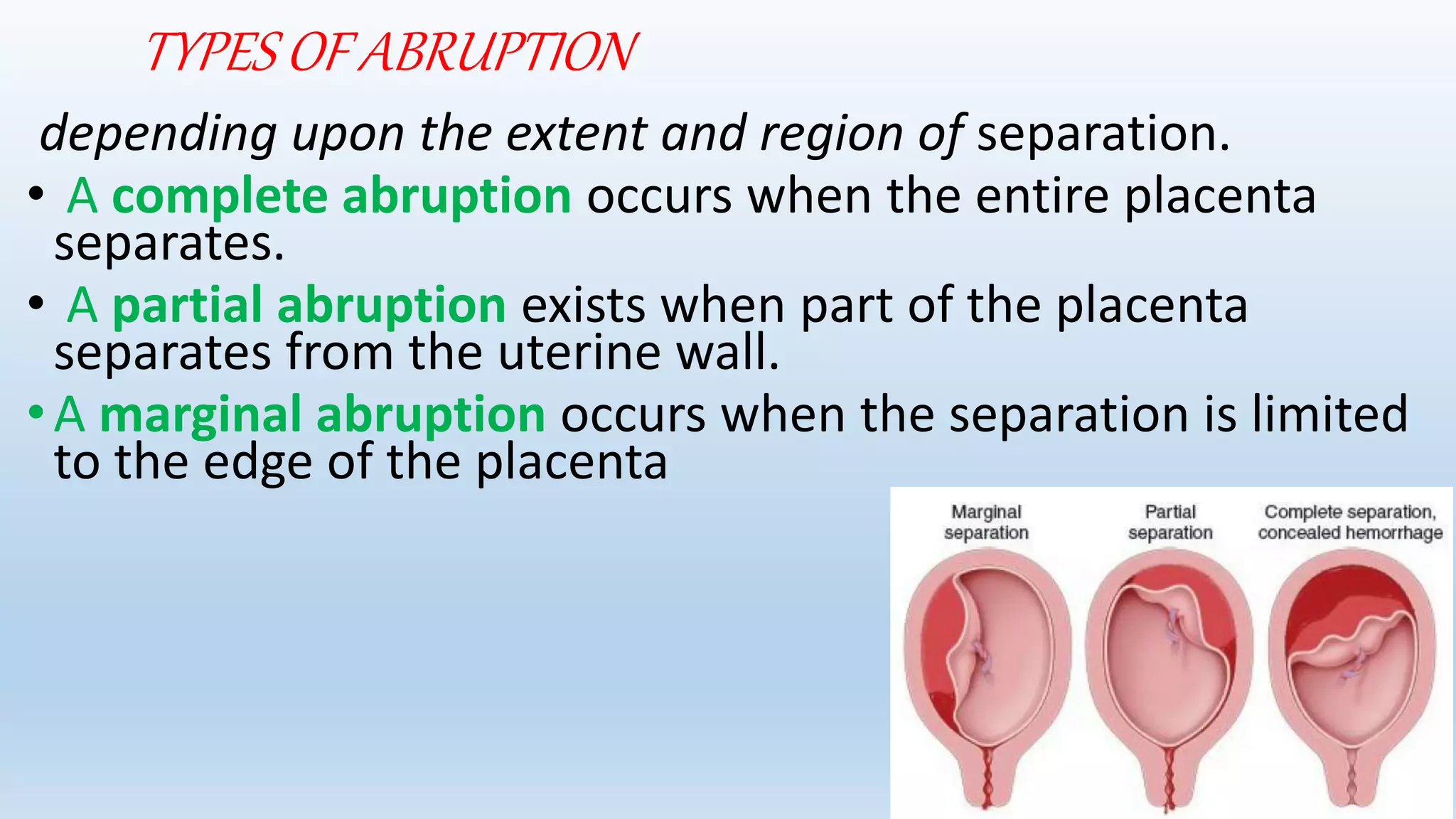 Abruptio placentae ppt | PPTX