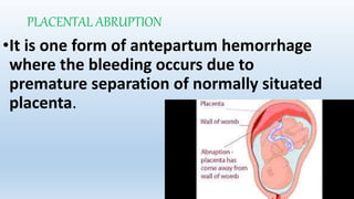 Abruptio Placentae