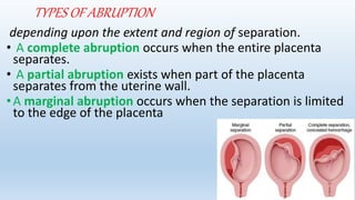 Placental Abruption Classification