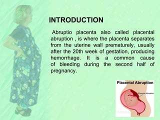 ABRUPTIO PLACENTAE | PPTX