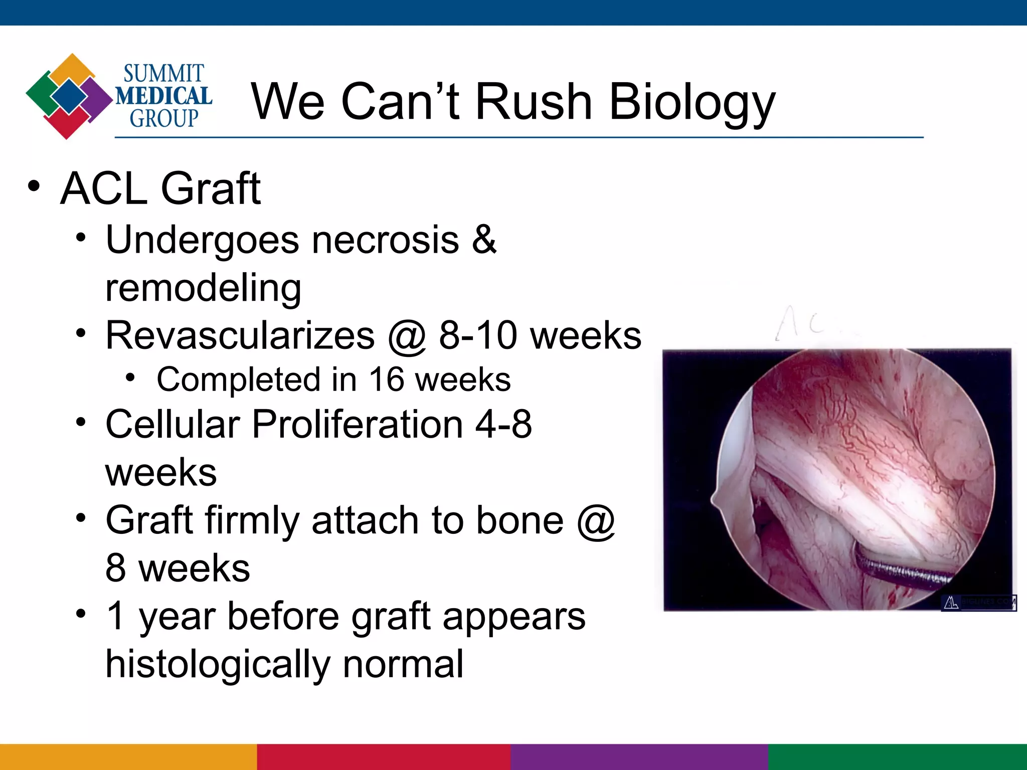 The Treatment of ACL Tears | PPT
