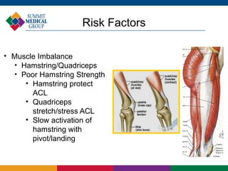 The Treatment of ACL Tears | PPT