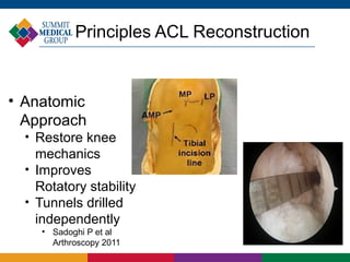 The Treatment of ACL Tears | PPT