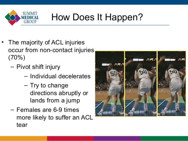 The Treatment of ACL Tears
