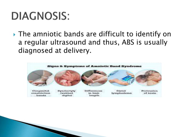 ABS AMNIOTIC BAND SYNDROM ORTHOPEDIE.pptx
