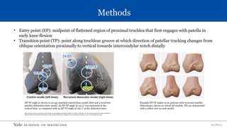 Tibial Tubercle Trochlear Groove Instability Risk | PPT