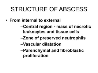 absces.pptx