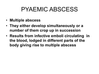 absces.pptx