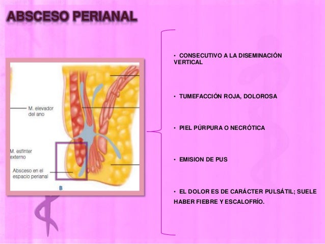 Anatomia Do Abscesso Anorretal