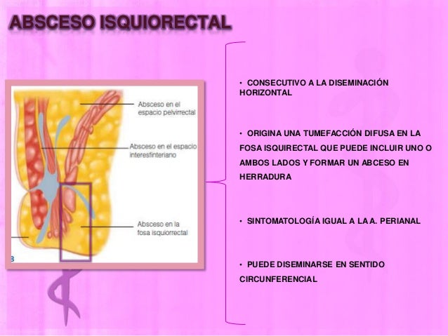Anatomia Do Abscesso Anorretal