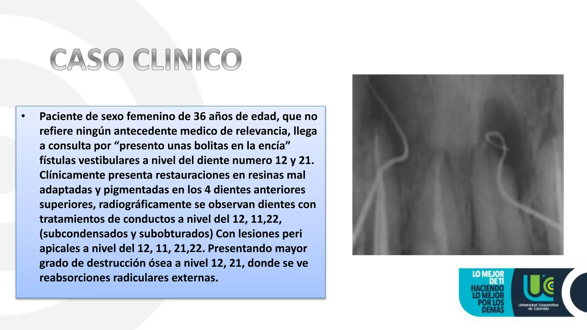 Absceso apical agudo y crónico | PPTX