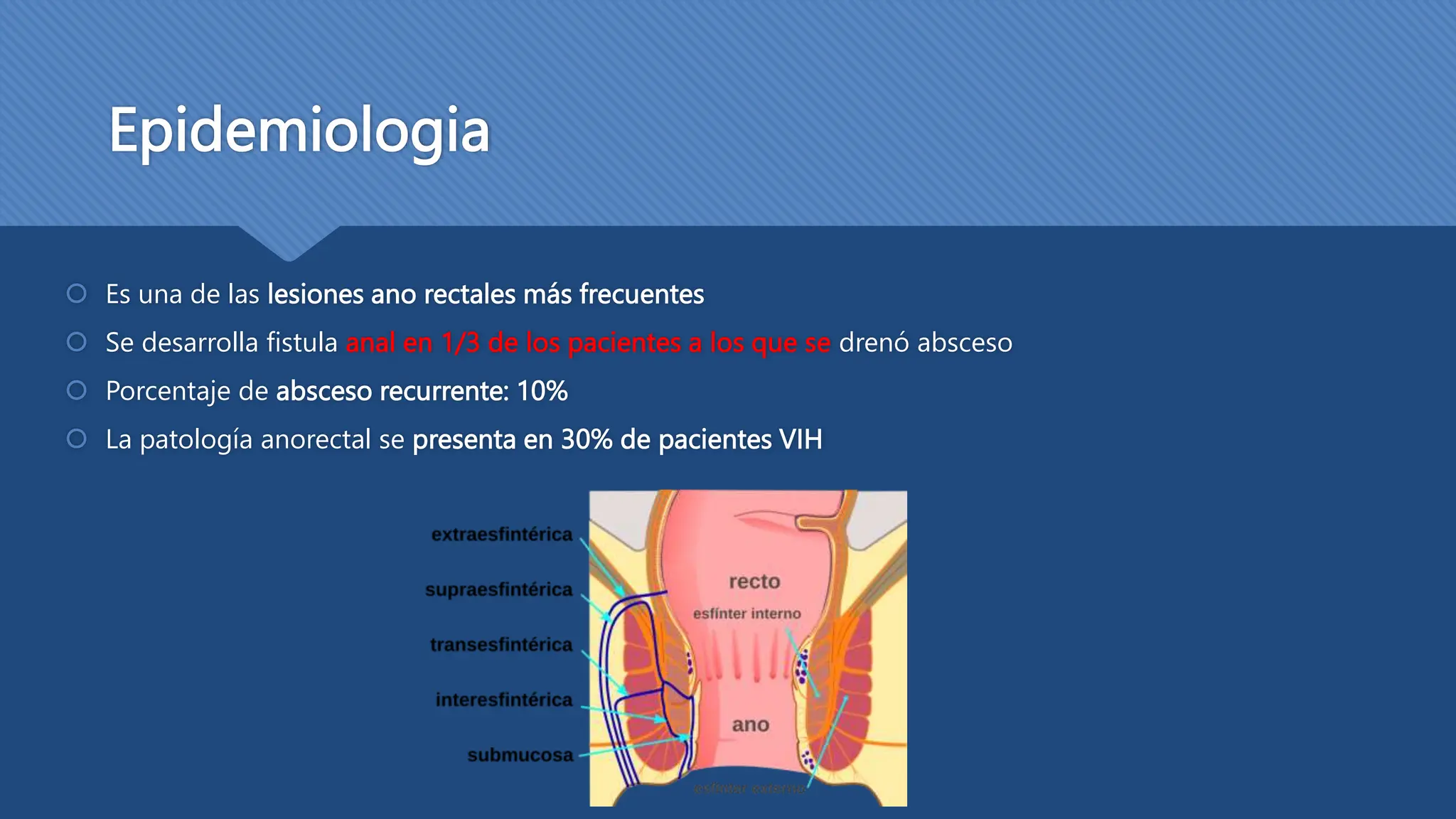 Absceso Anal.pptx