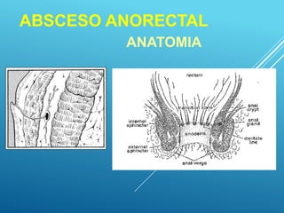 abscesoanorectal.ppt