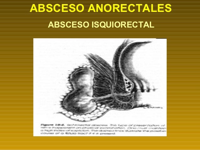 Anatomia Do Abscesso Anorretal