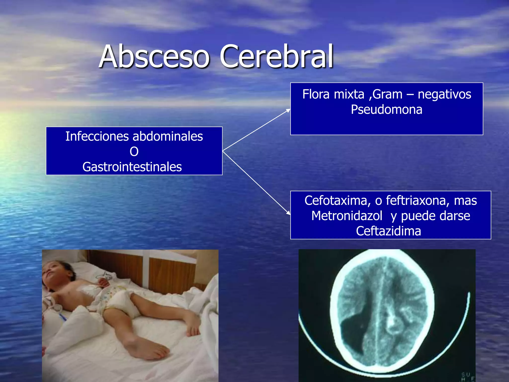 Absceso cerebral 2020 | PPT | Brain and Nervous System Disorders ...