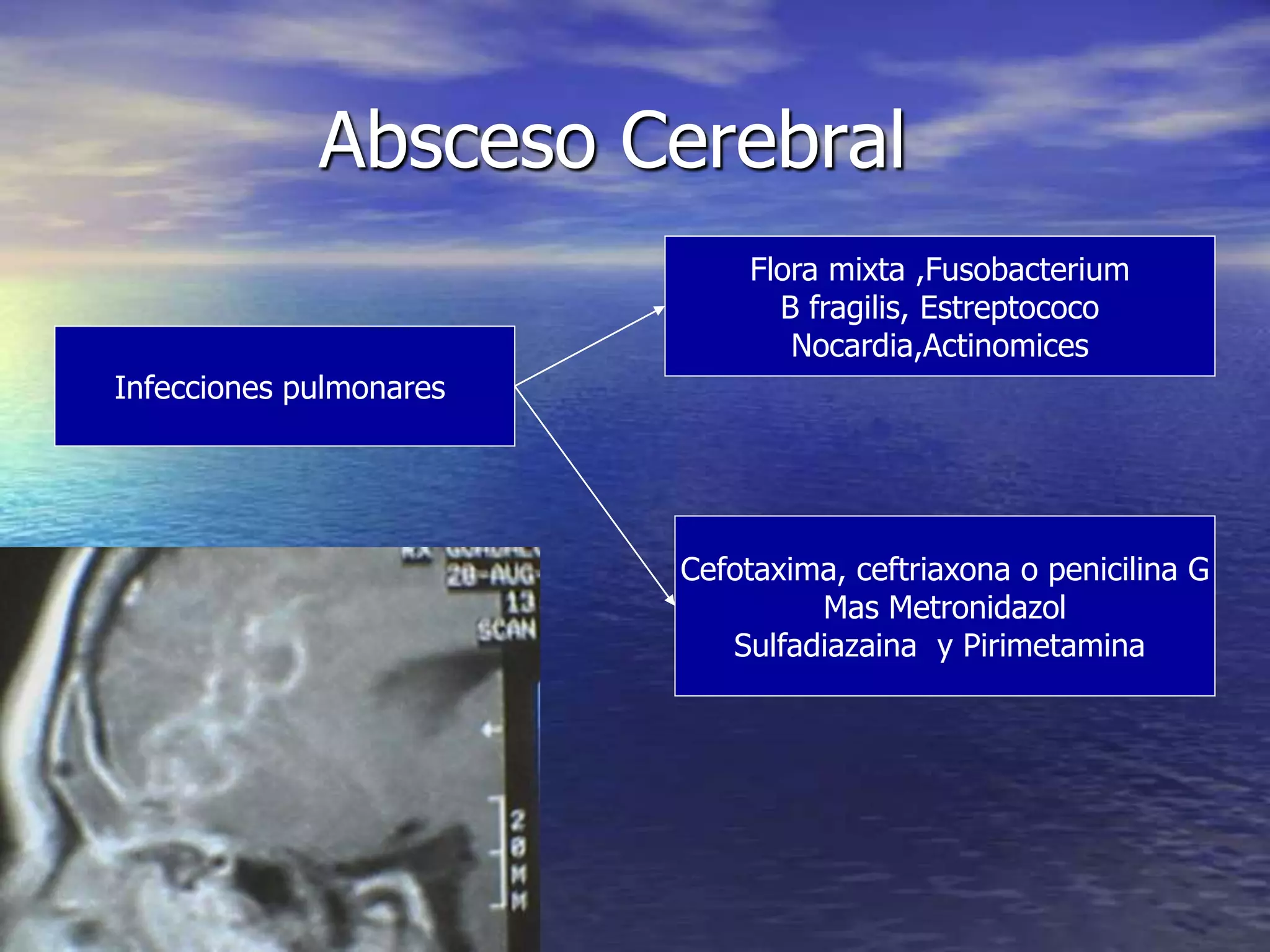 Absceso cerebral 2020 | PPT | Brain and Nervous System Disorders ...