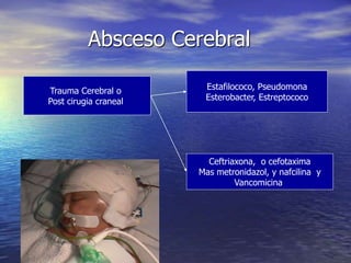 Absceso cerebral 2020 | PPT